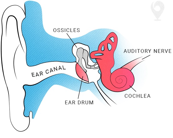 Sensorineural Hearing Loss - ZipHearing